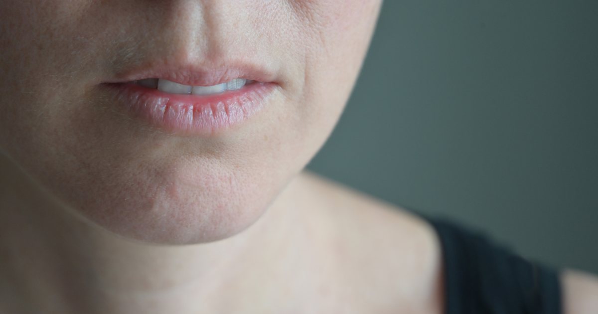 Dry Lips: Common Causes and What Doctors Recommend for Relief